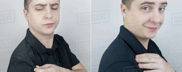 Dandruff before and after. The man on the left shows his shoulder ...