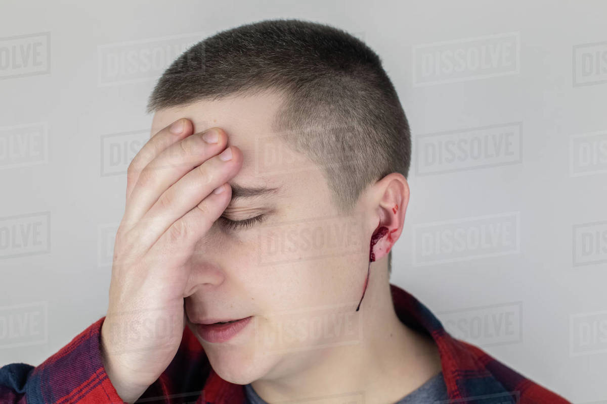 A man whose ear is bleeding. Vascular rupture, damage to the tympanic ...
