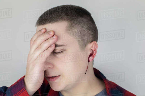 A man whose ear is bleeding. Vascular rupture, damage to the tympanic ...