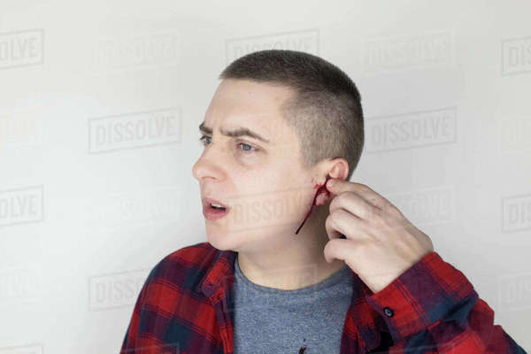 A man whose ear is bleeding. Vascular rupture, damage to the tympanic ...
