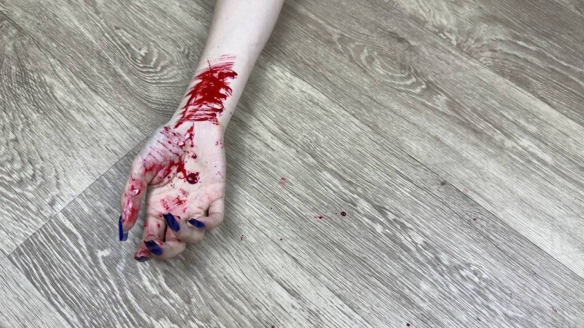 Hand of young girl has traces of vein cuts after committing suicide ...