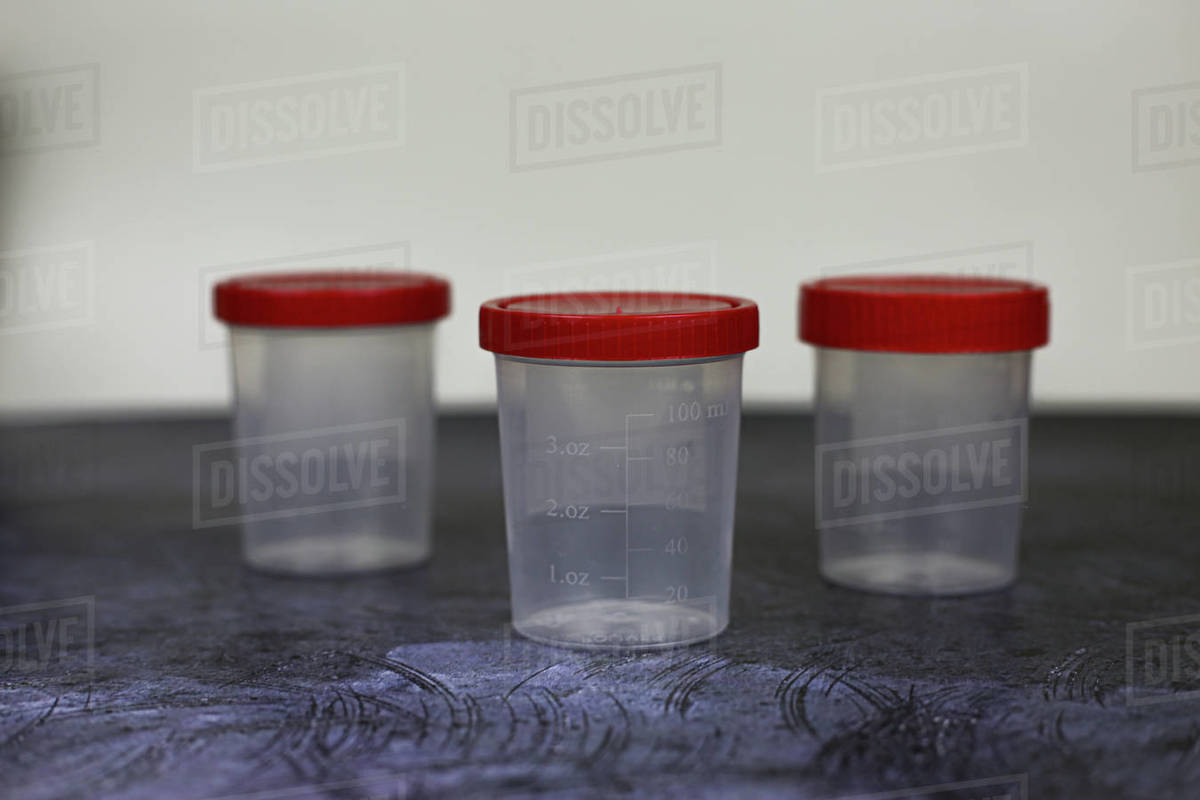 Laboratory plastic jars with a red lid for testing in the hospital ...