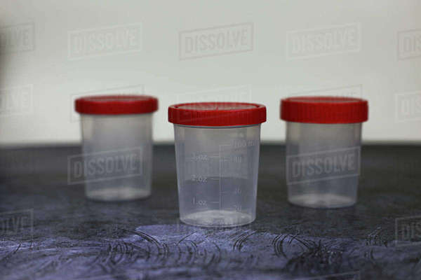 Laboratory plastic jars with a red lid for testing in the hospital ...