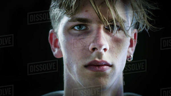Close-up Portrait Shot of a Drug Addict Suffering Young Boy Sadly ...