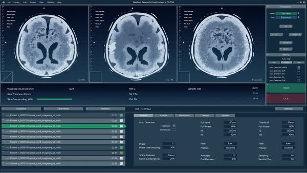 Computed Tomography Chest Scan Mock-up with Multiple Windows and Data ...