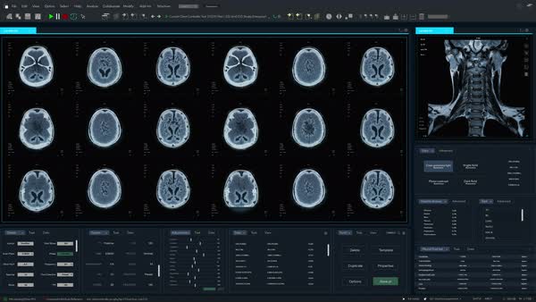 Magnetic Resonance Imaging Brain Scan Mock-up with Multiple Windows and ...