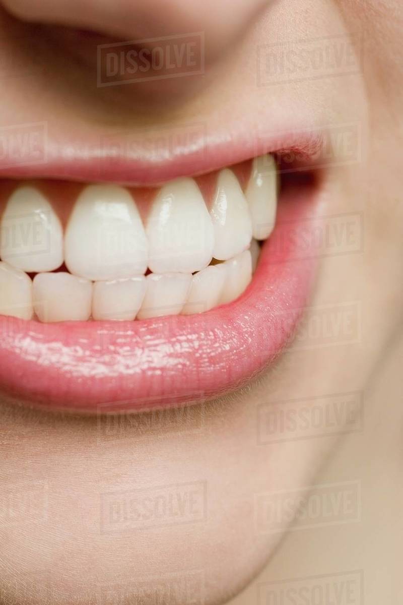 Teeth Clenched - Stock Photo - Dissolve