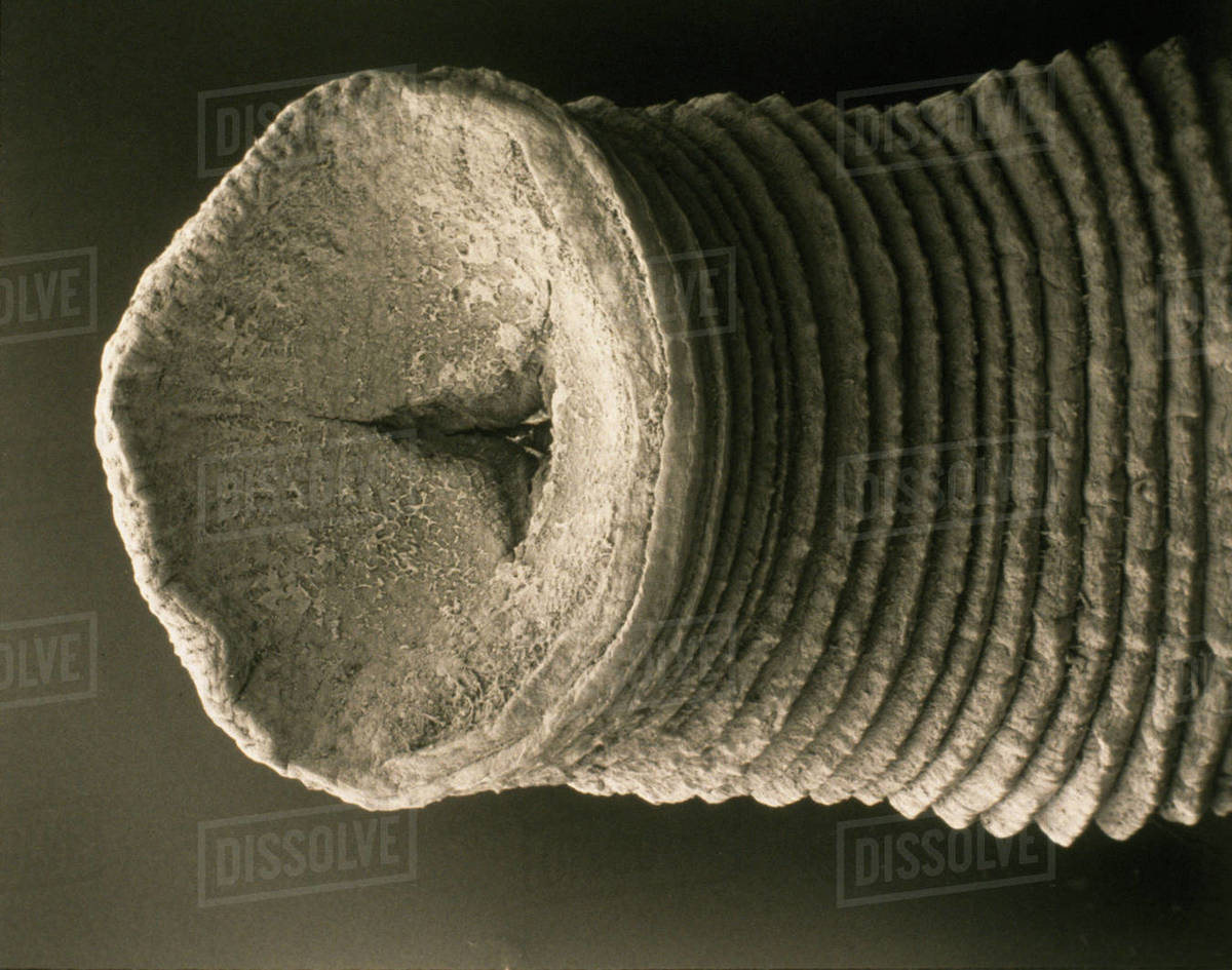 Scanning electron microscopic view of a medicinal leech (Hirudo ...