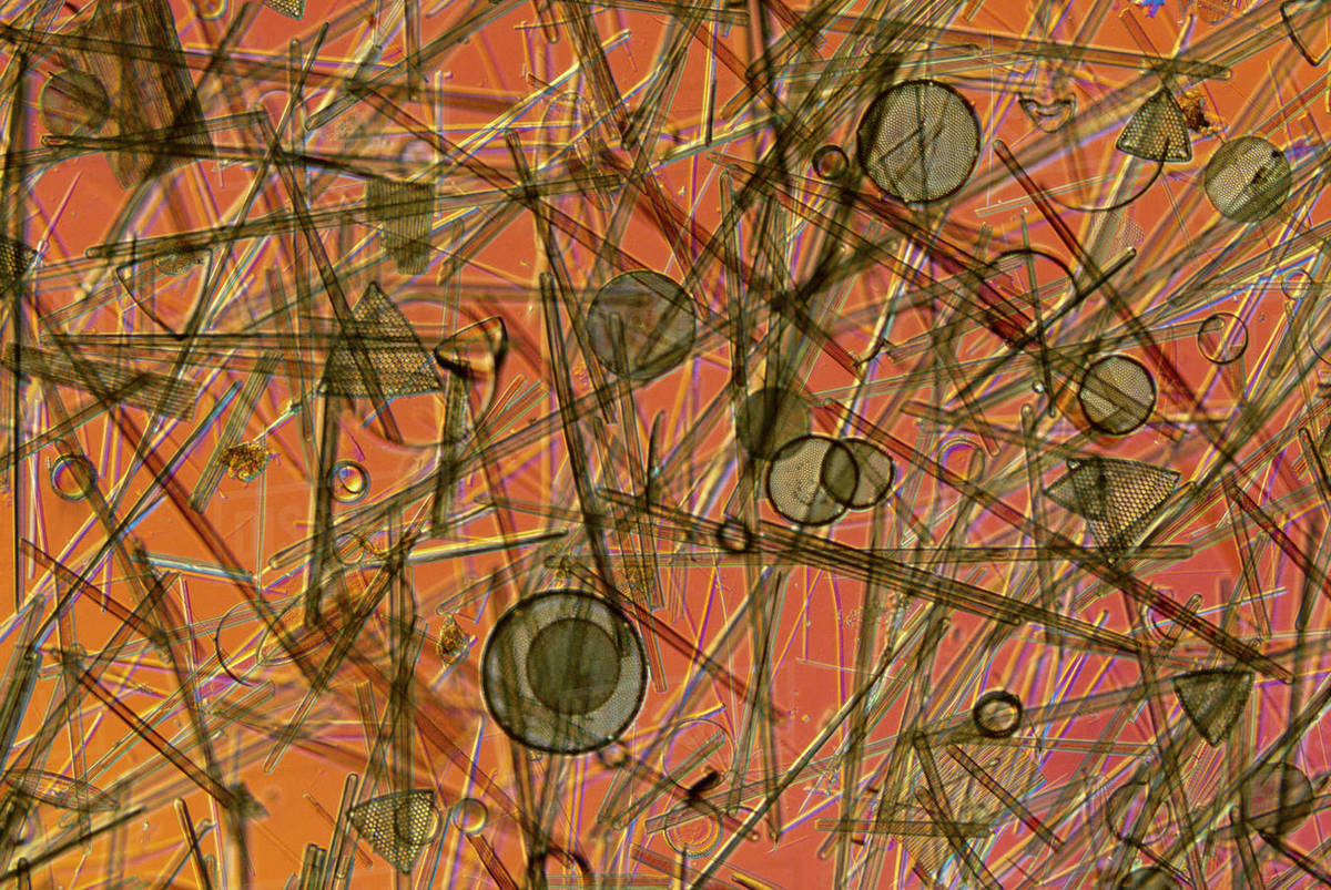 Microscopic view of diatoms. Diatoms reproduce by both simple cell ...
