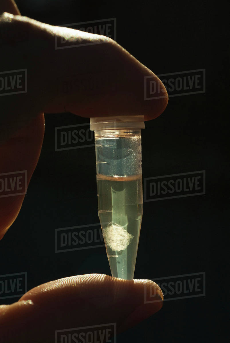 Dna isolated from a drop of bird blood and suspended in isopropanol ...