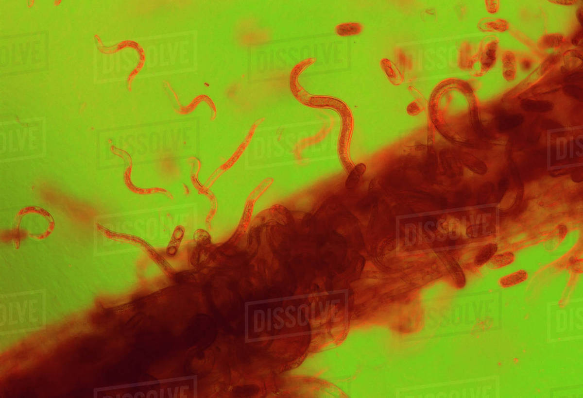 Agriculture - Root Lesion Nematodes (Pratylenchus neglectus) swimming ...