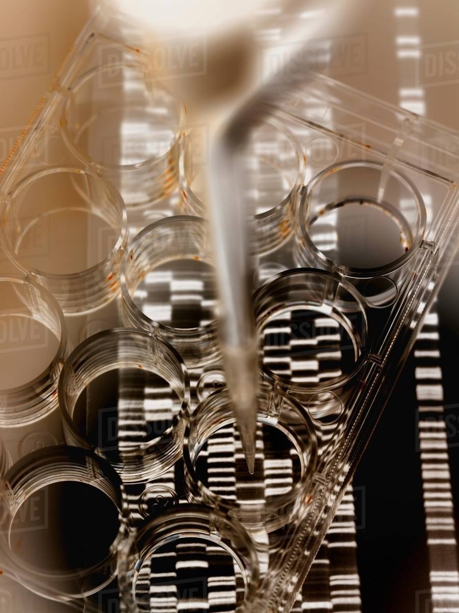 Pipette adding DNA sample to tray for DNA testing, DNA gel results in ...