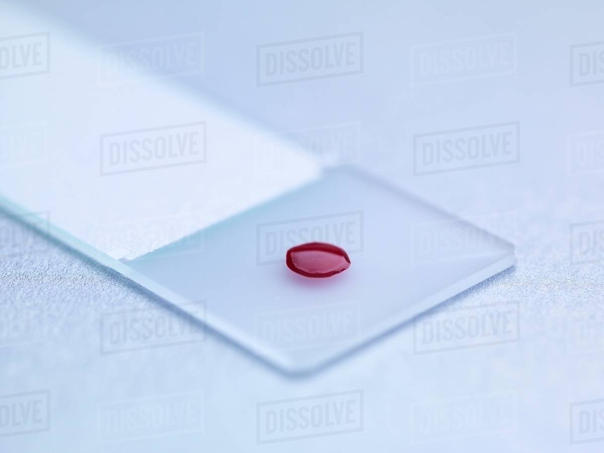 Blood sample on microscopic slide - Stock Photo - Dissolve