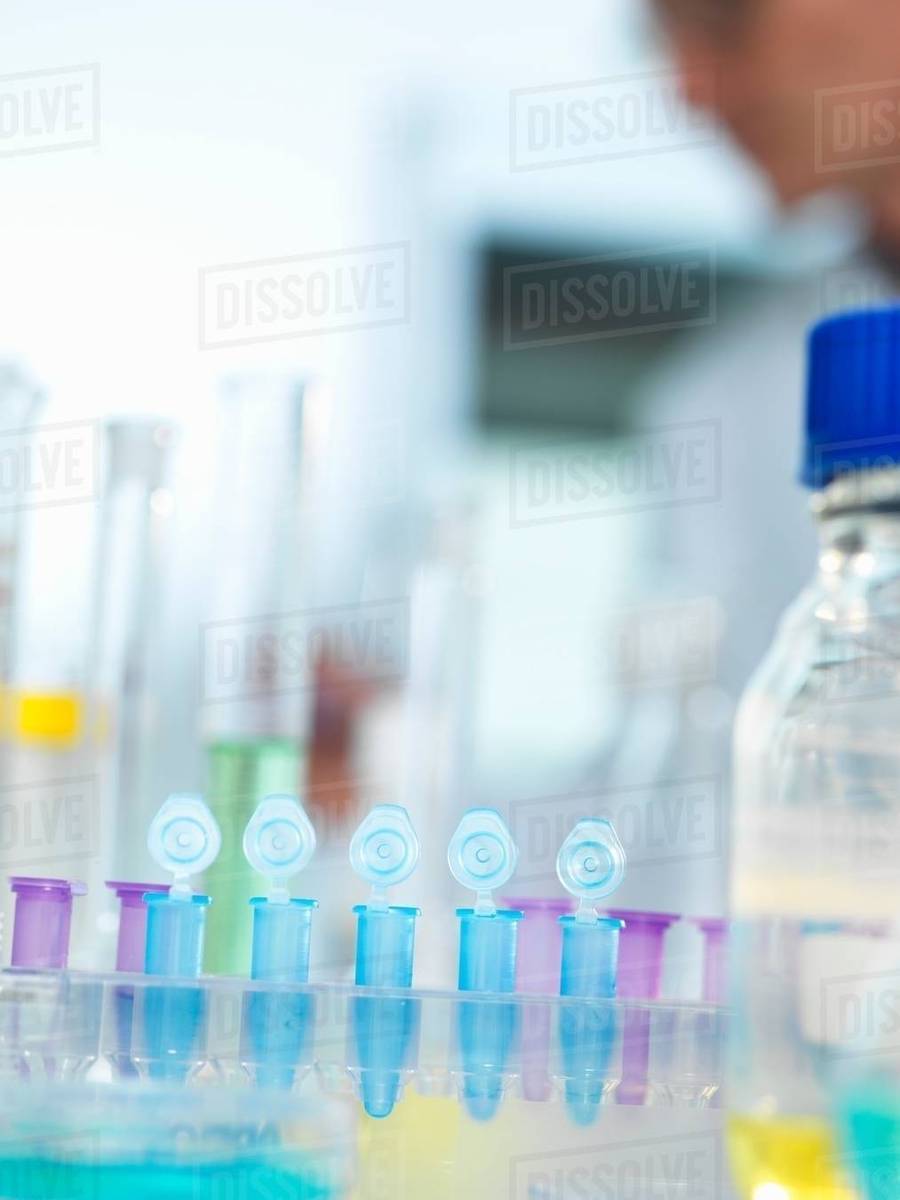 Row of eppendorf vial awaiting sample for testing in laboratory ...