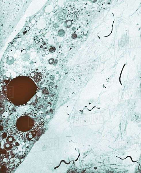 Electron micrograph of Treponema pallidum bacteria - Stock Photo - Dissolve