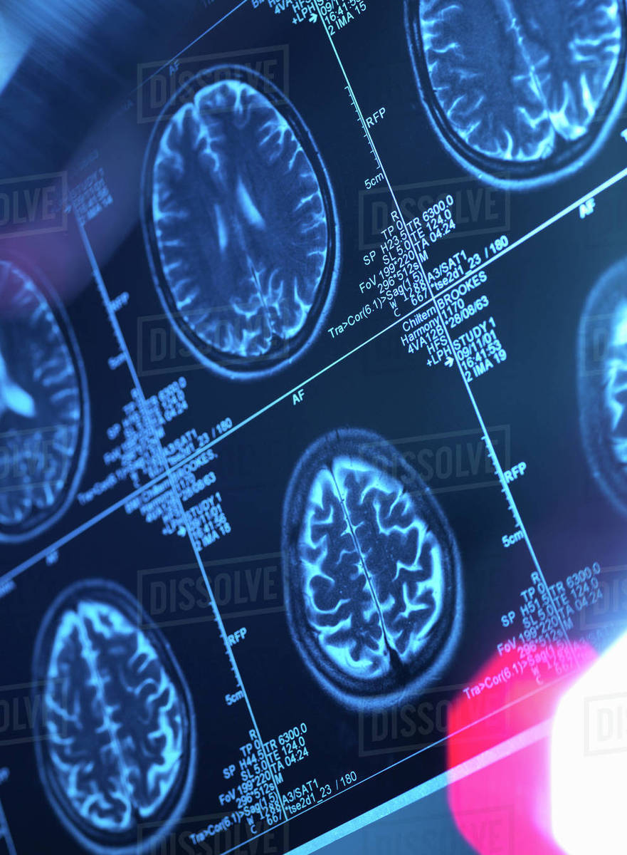 Human brain scan in a neurology clinic - Royalty-free Stock Photo ...