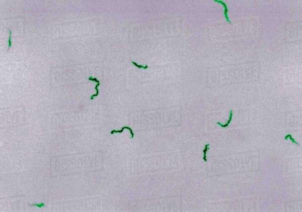Photomicrograph of Treponema pallidum bacteria - Stock Photo - Dissolve