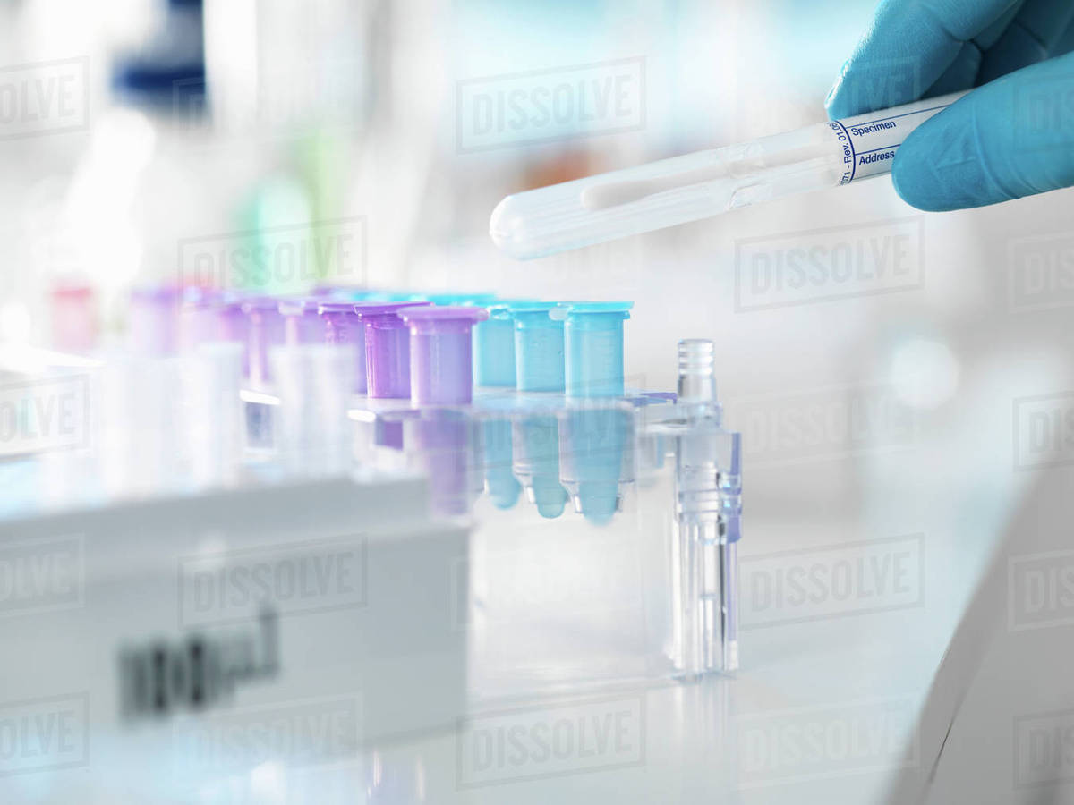 Scientist preparing a DNA swab for analysis in a laboratory for ...