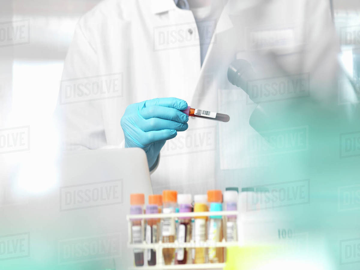 Scientist checking blood sample information ready for clinical testing ...