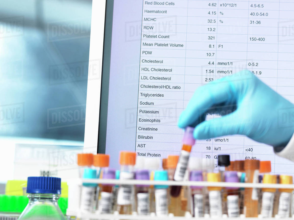 Health Check Results, Haematologist checking medical samples including ...