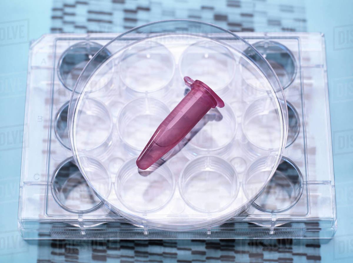 DNA sample inside vial on multi well plate, DNA gel showing results ...