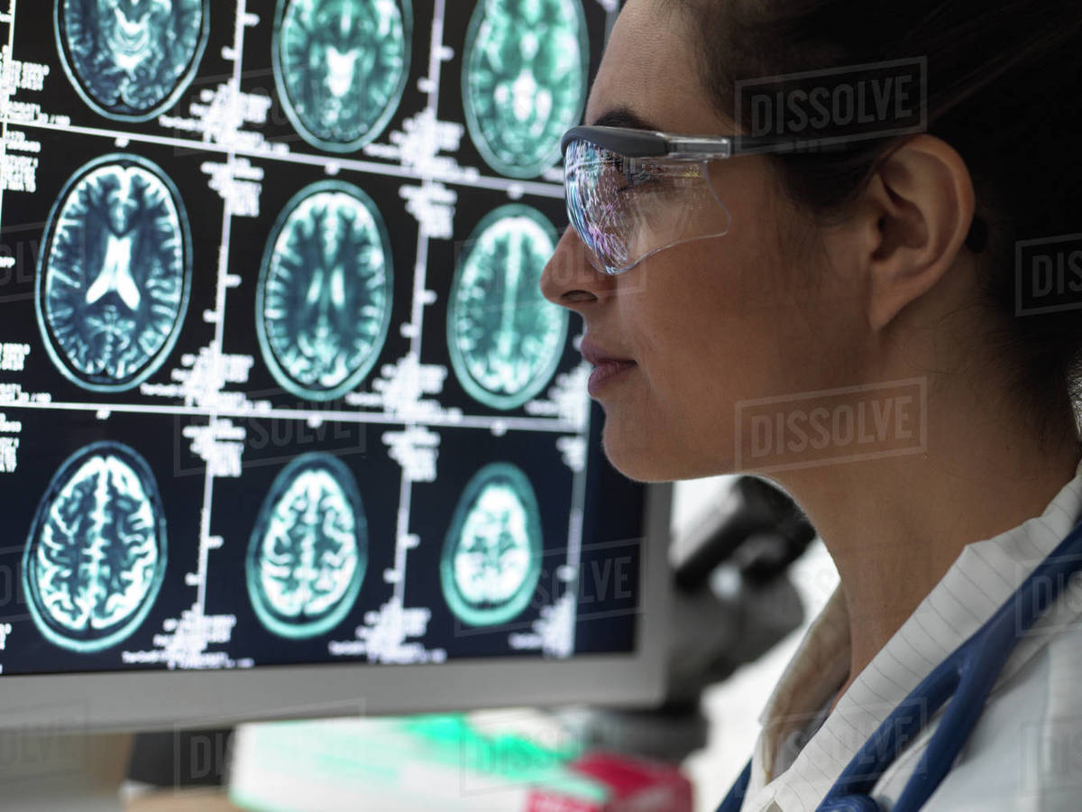 Neurology Diagnosis, Human brain scan on a screen being analysed by a ...