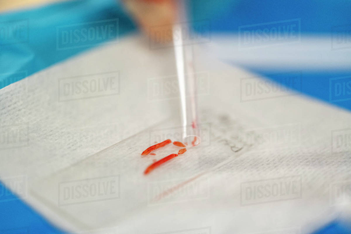 A close-up view of a blood sample being manipulated with tweezers on a ...