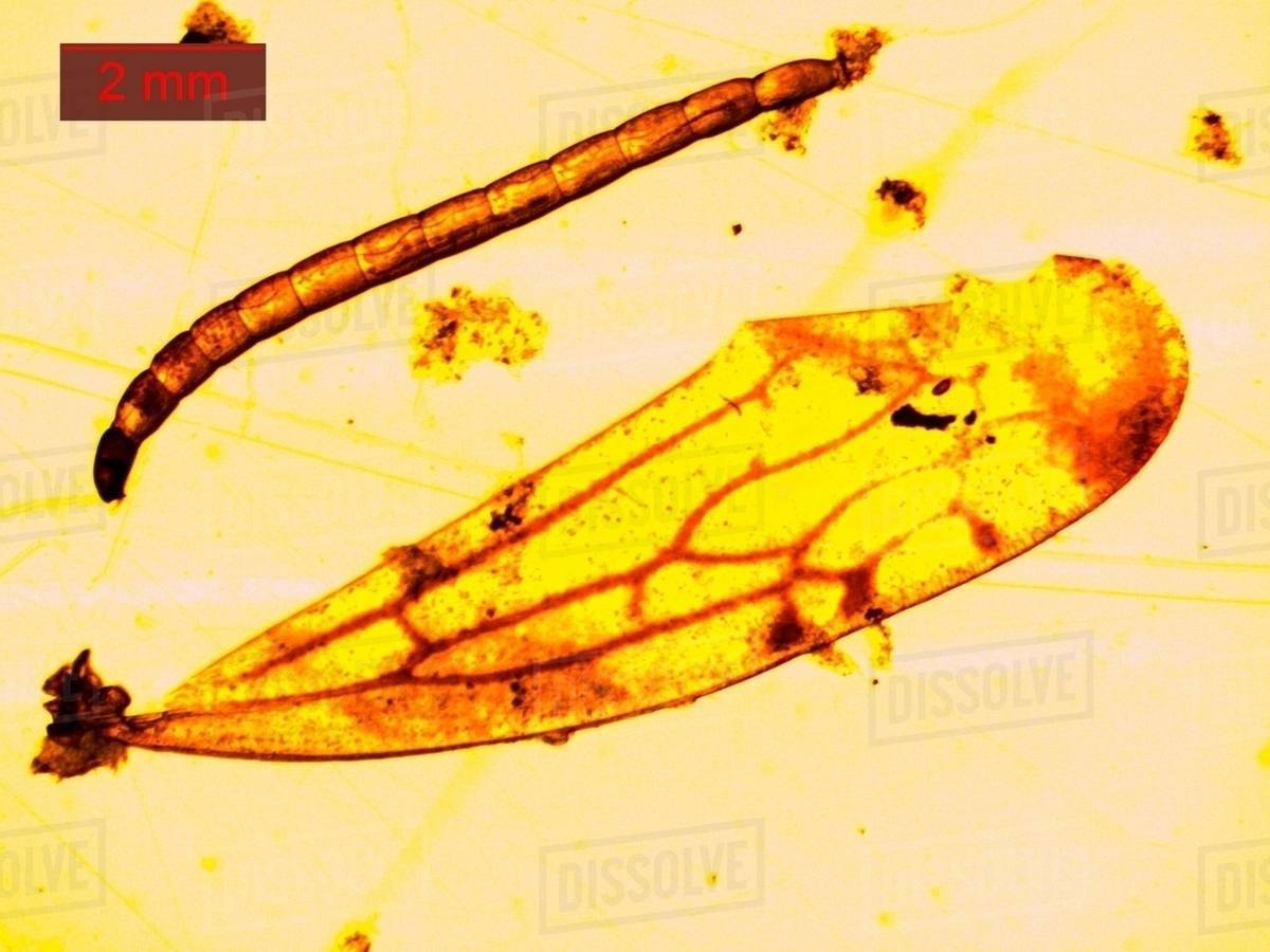 Mosquito larva under a microscope - Royalty-free Stock Photo | Dissolve