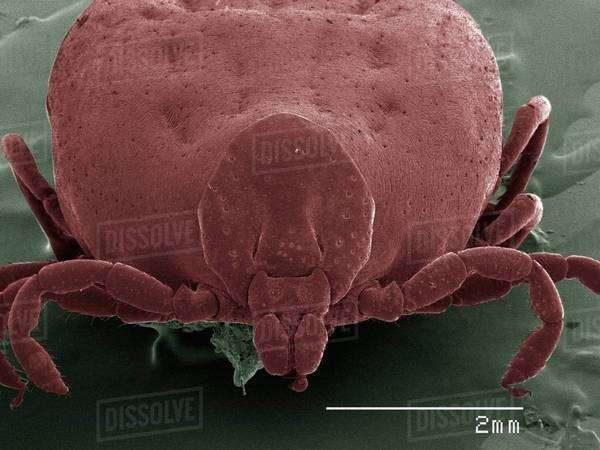 Coloured SEM of tick, front view - Royalty-free Stock Photo | Dissolve