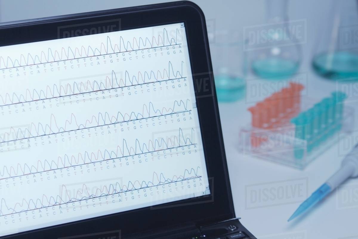 A laptop computer displays results of automated DNA sequencing on its ...
