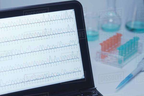 A laptop computer displays results of automated DNA sequencing on its ...
