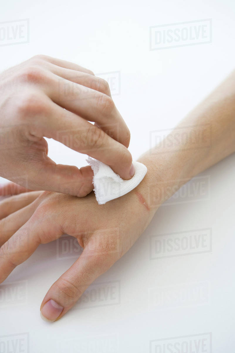 Person holding gauze against wounded hand, cropped view - Royalty-free ...