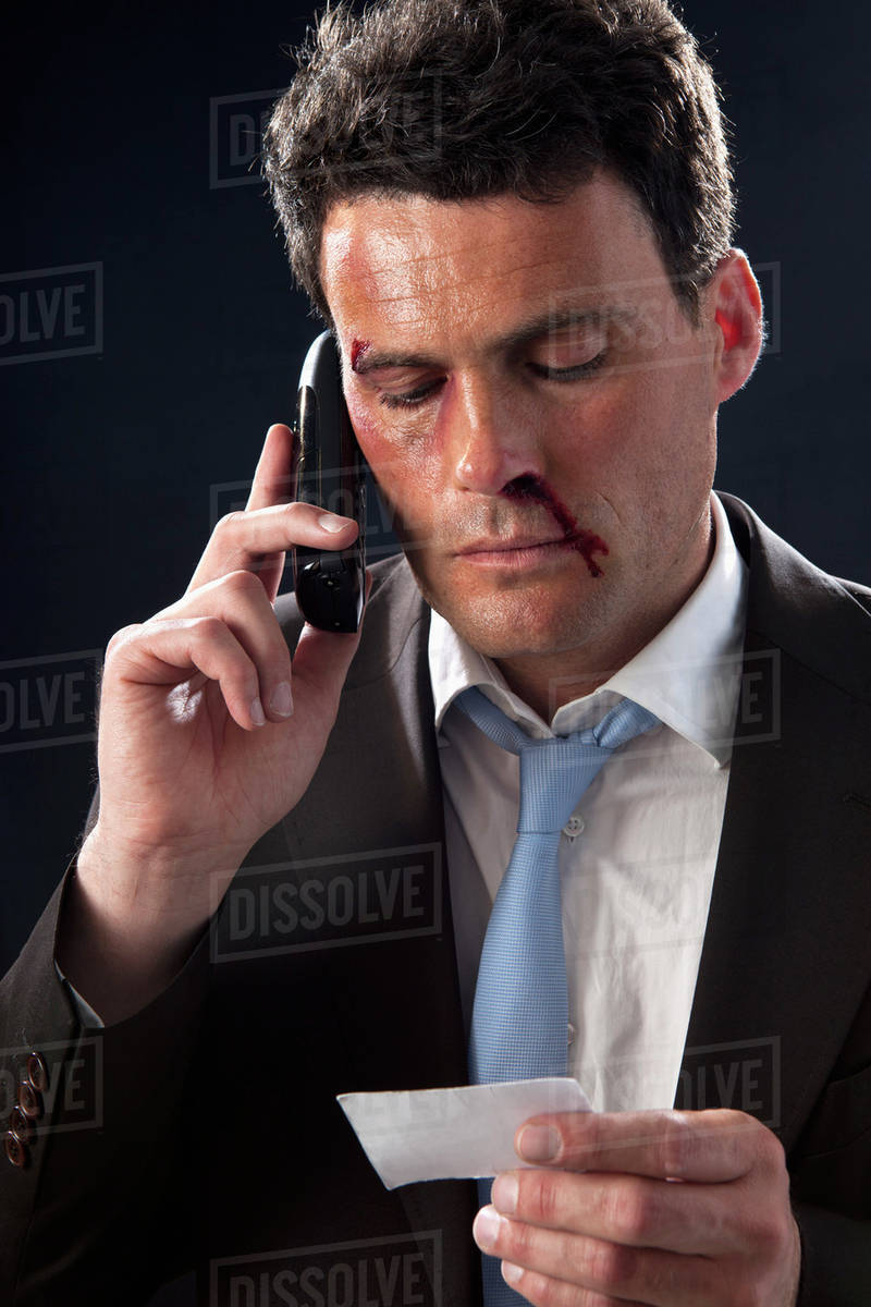 A businessman with bruises and a bloody nose looking at a business card ...